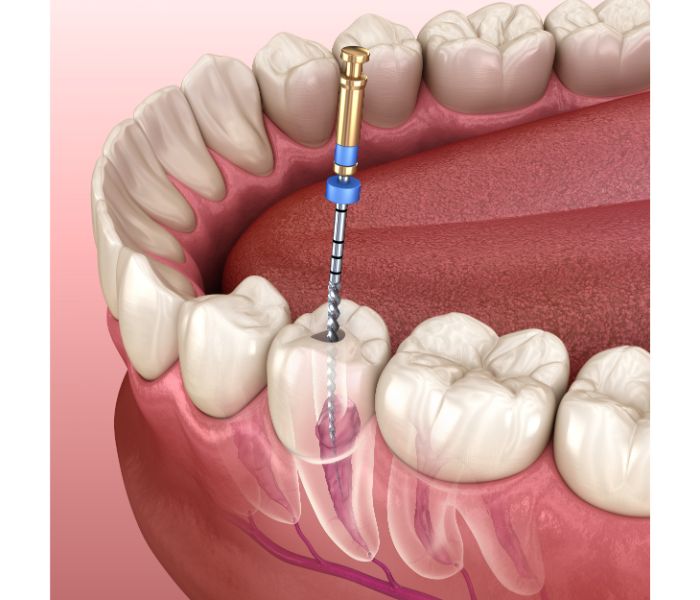 Servicios – OdontoPacifico